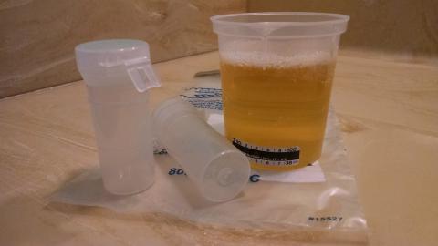 Dilute Samples - What is a dilute? Should I be concerned? | Mobile ...